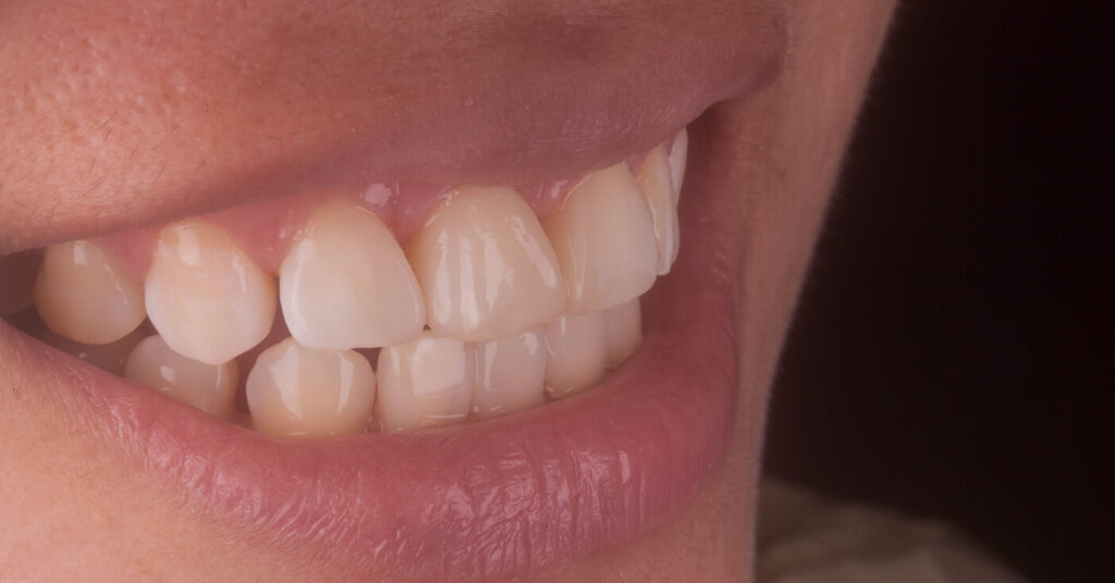 Home - Indent Dental Surgery